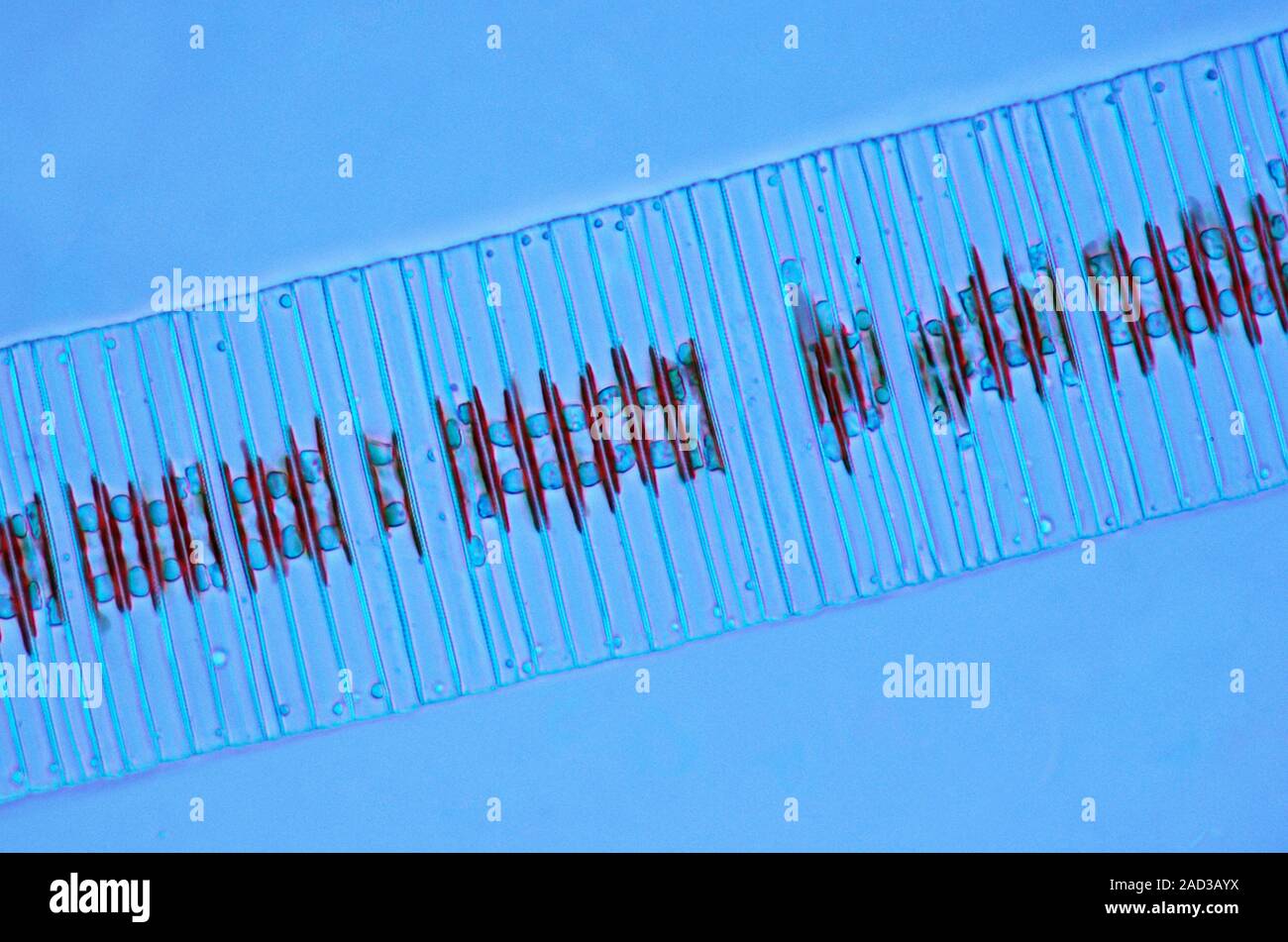 Fragilaria diatoms. Polarised light micrograph of Fragilaria sp ...