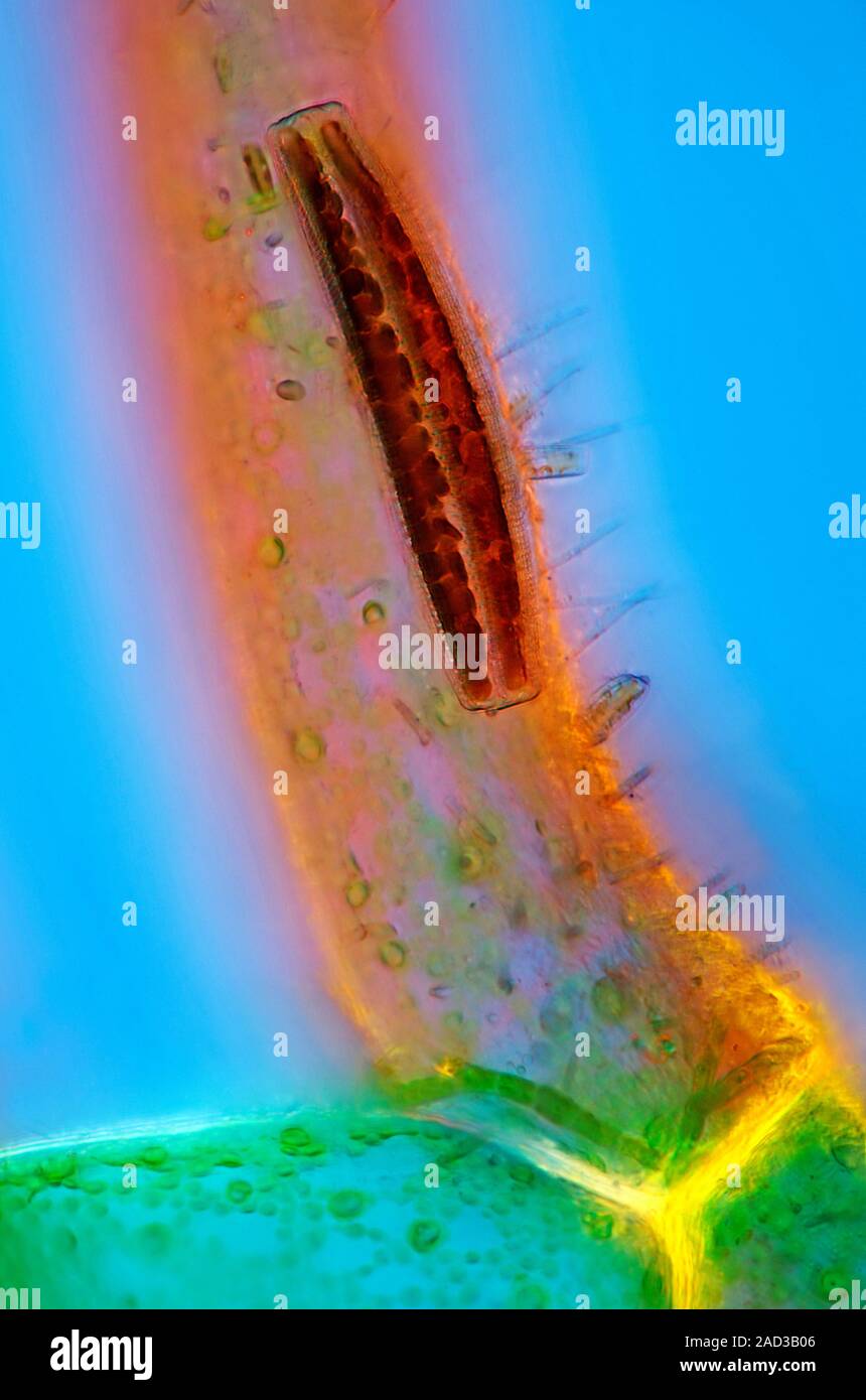 Epithemia diatom. Polarised light micrograph of a Epithemia sp. diatom ...