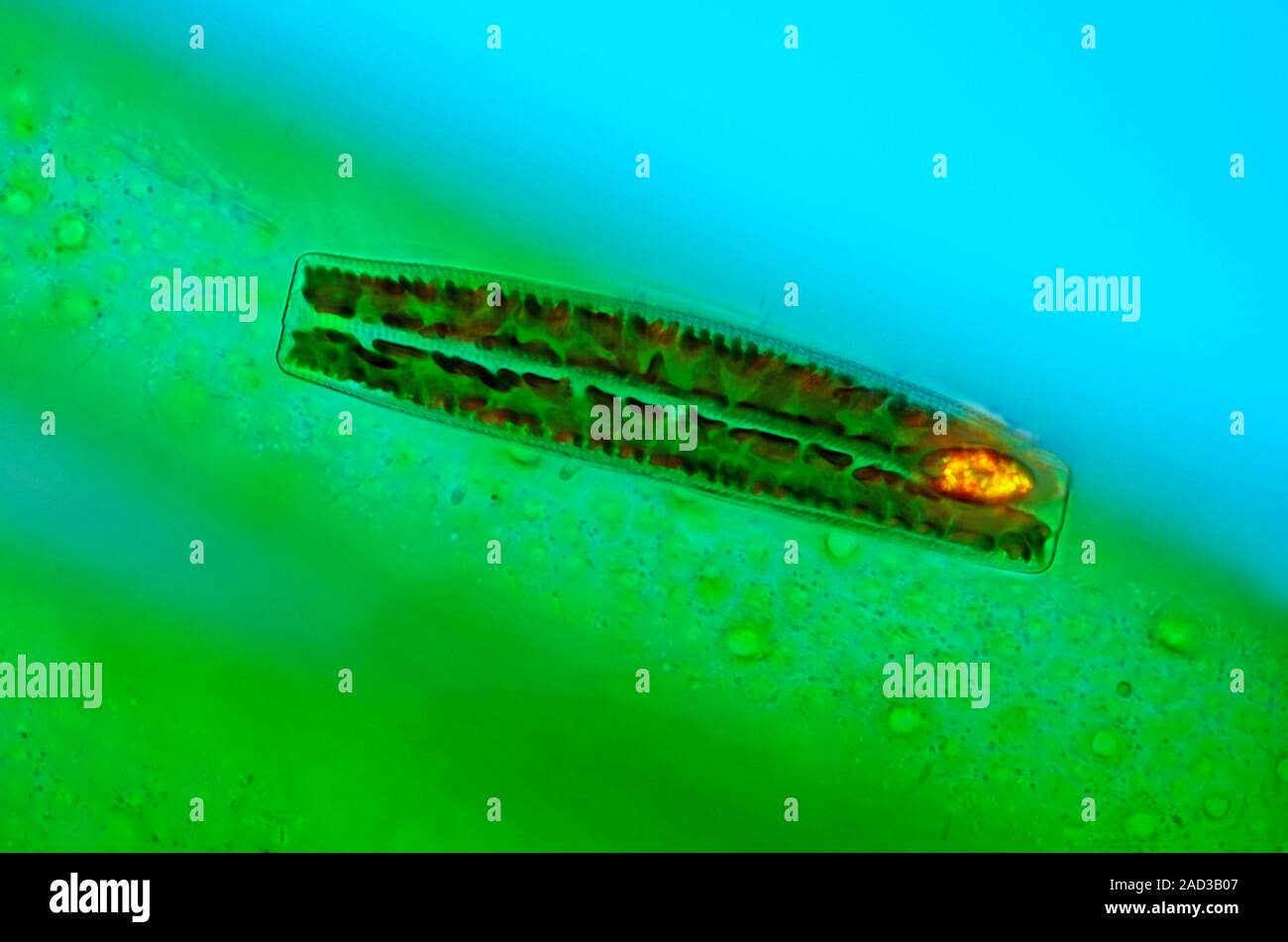 Epithemia diatom. Polarised light micrograph of a Epithemia sp. diatom ...