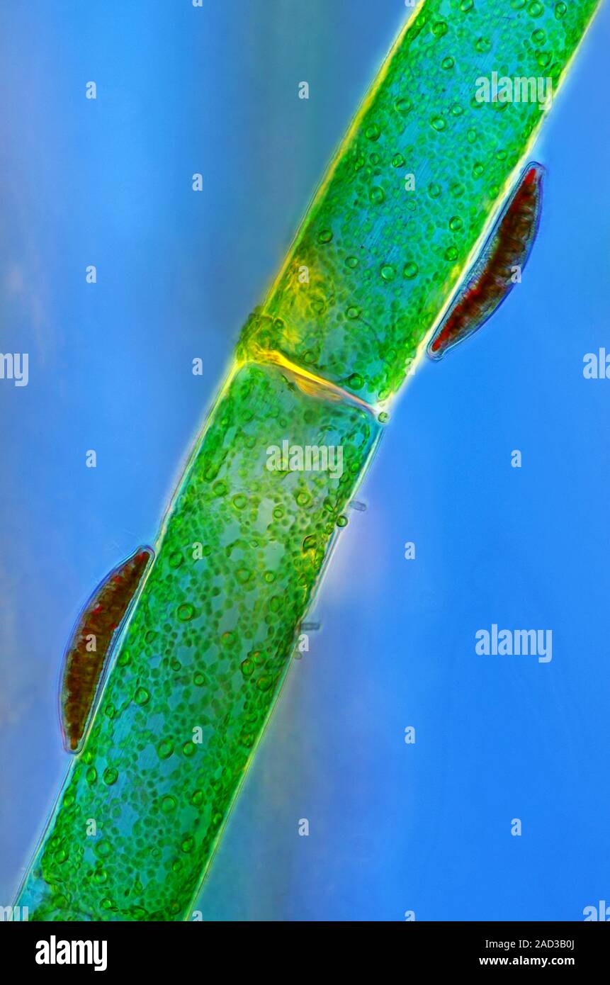 Epithemia diatoms. Polarised light micrograph of Epithemia sp. diatom ...