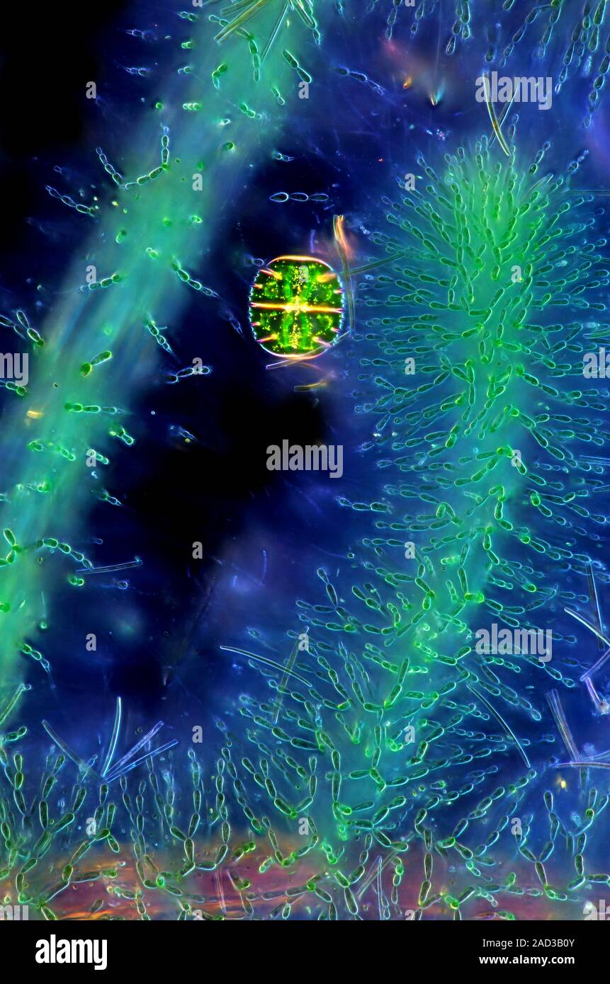 Desmid on red algae. Darkfield illuminated polarised light micrograph ...