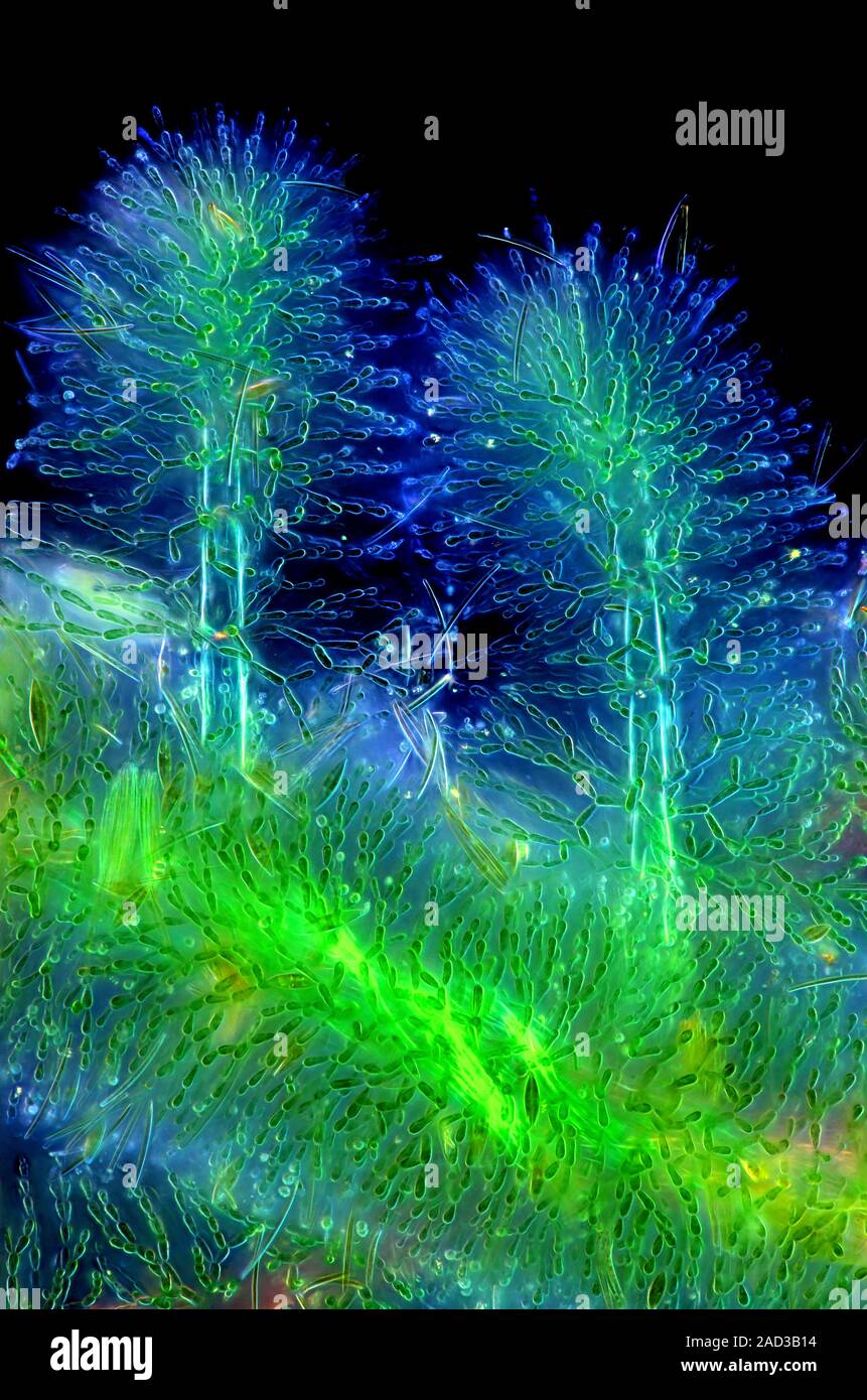 Diatoms on red algae. Darkfield illuminated polarised light micrograph ...