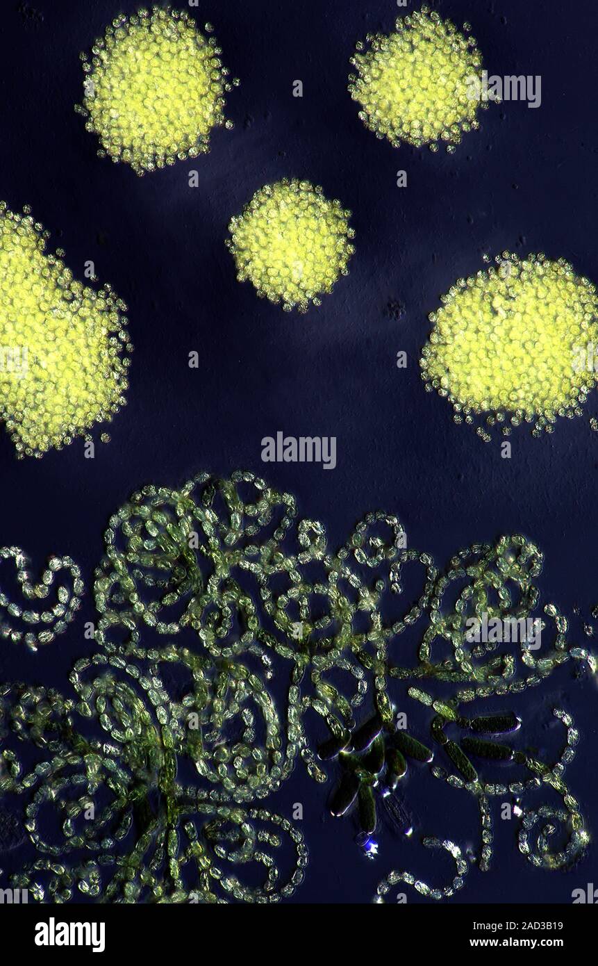 Cyanobacteria. Darkfield illuminated polarised light micrograph of ...