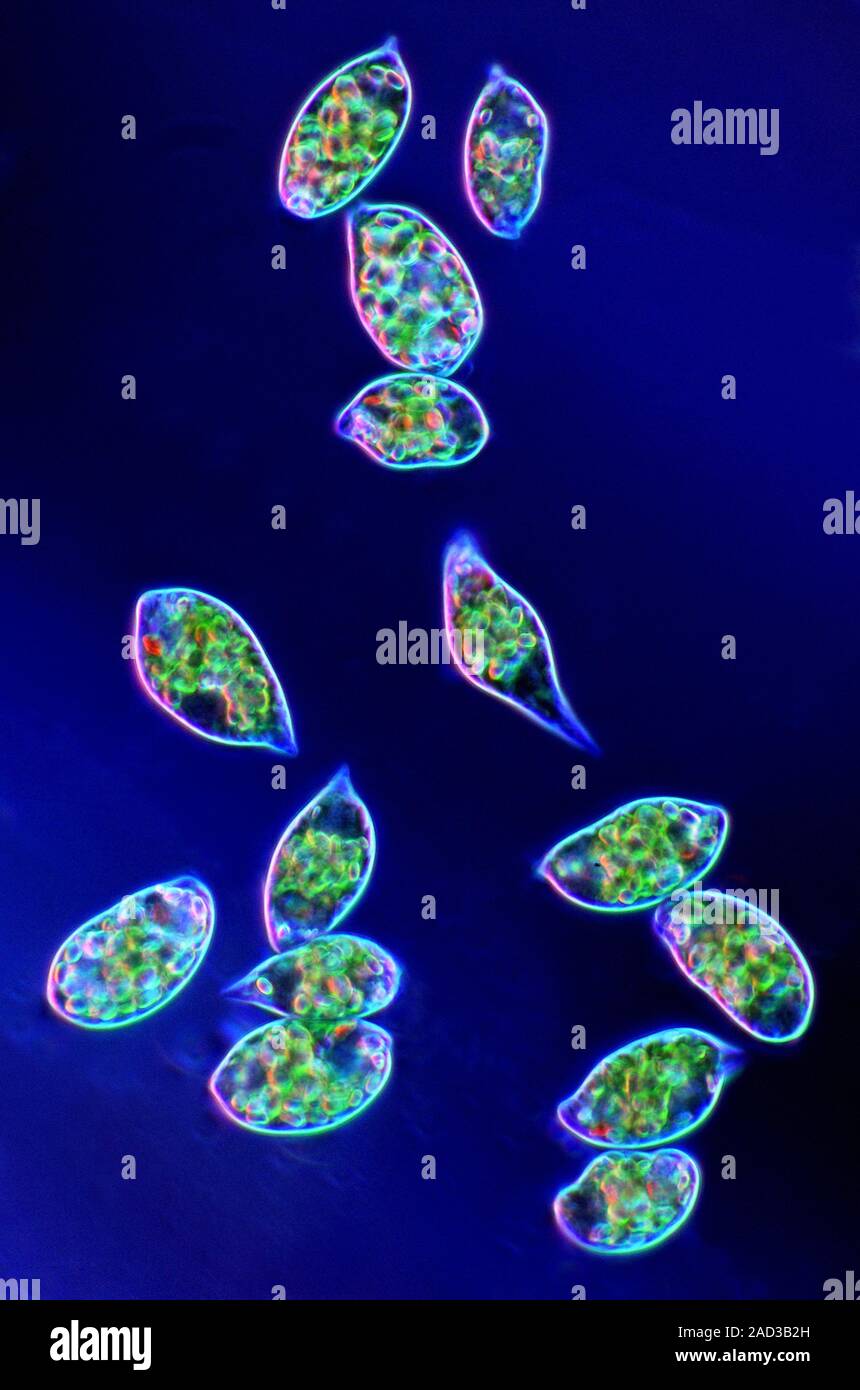 Euglena protozoa. Darkfield illuminated polarised light micrograph of ...
