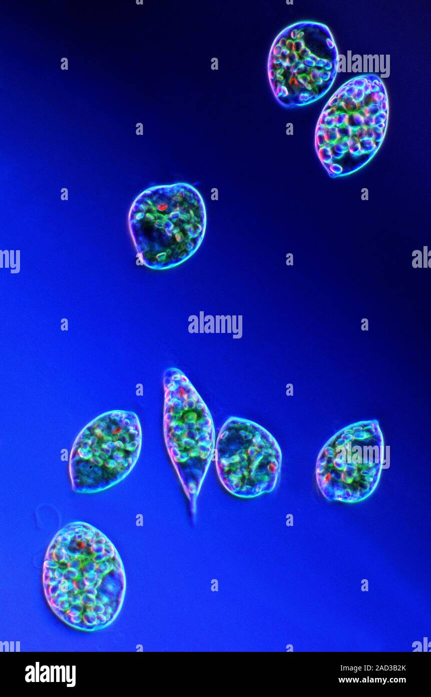 Euglena protozoa. Darkfield illuminated polarised light micrograph of ...