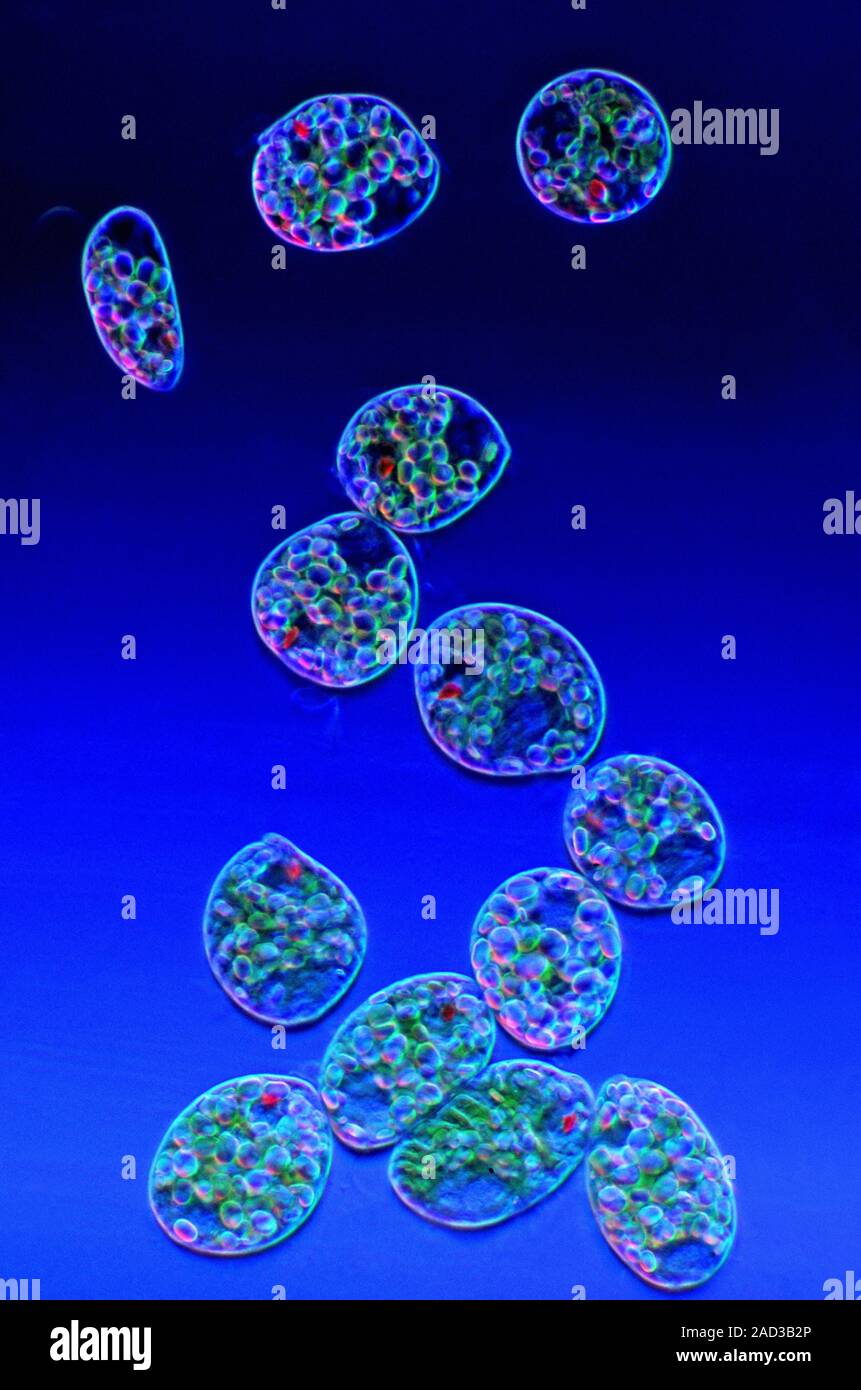 Euglena protozoa. Darkfield illuminated polarised light micrograph of ...