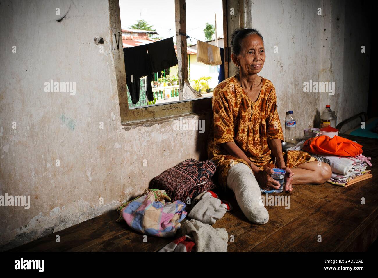 An elderly woman who has lost part of her right leg as a result of ...