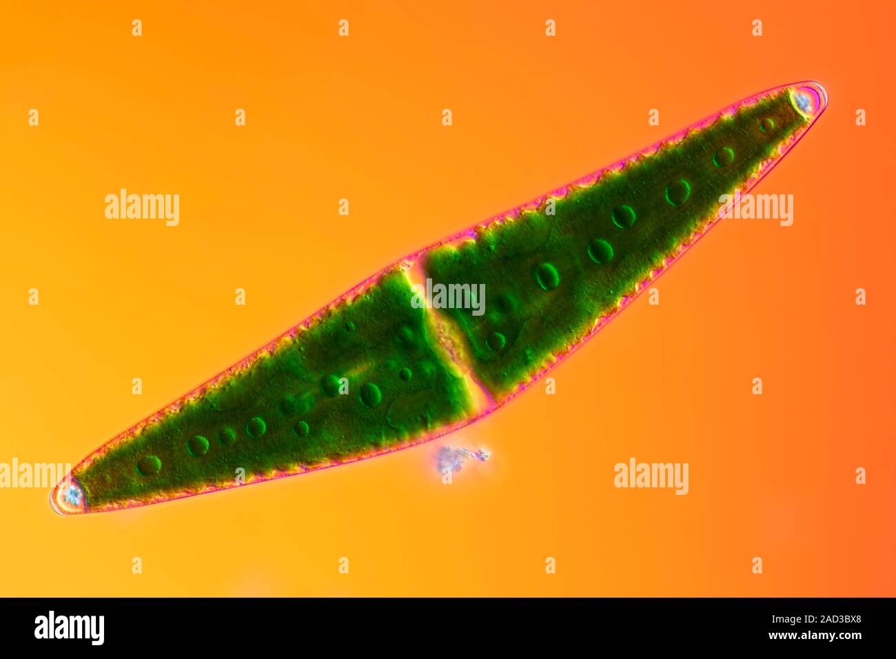 Closterium desmid. Differential interference contrast (DIC) light ...
