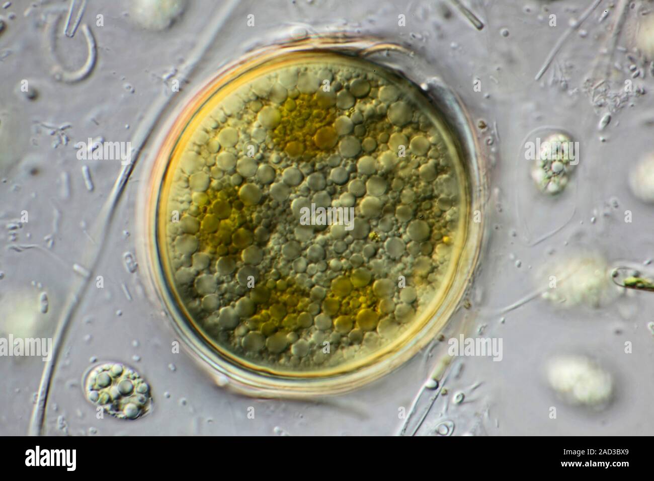 Desmid zygote. Differential interference contrast (DIC) light ...