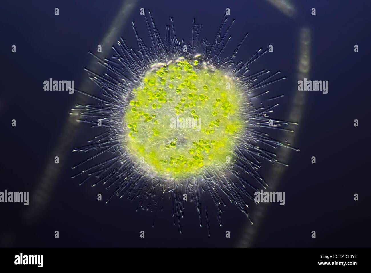 Heliozoa protozoan. Differential interference contrast (DIC) light ...