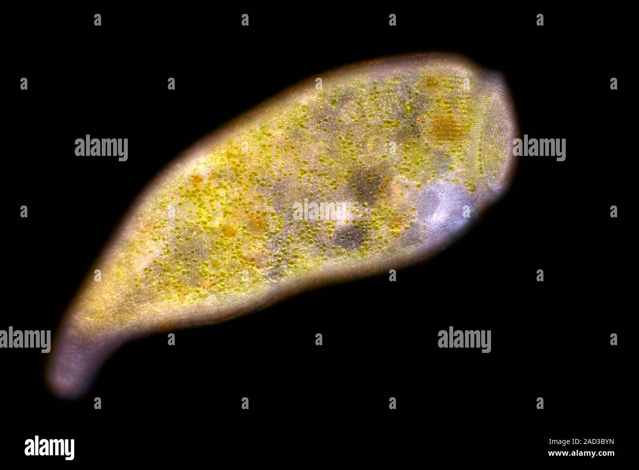 Stentor ciliate protozoan. Differential interference contrast (DIC ...