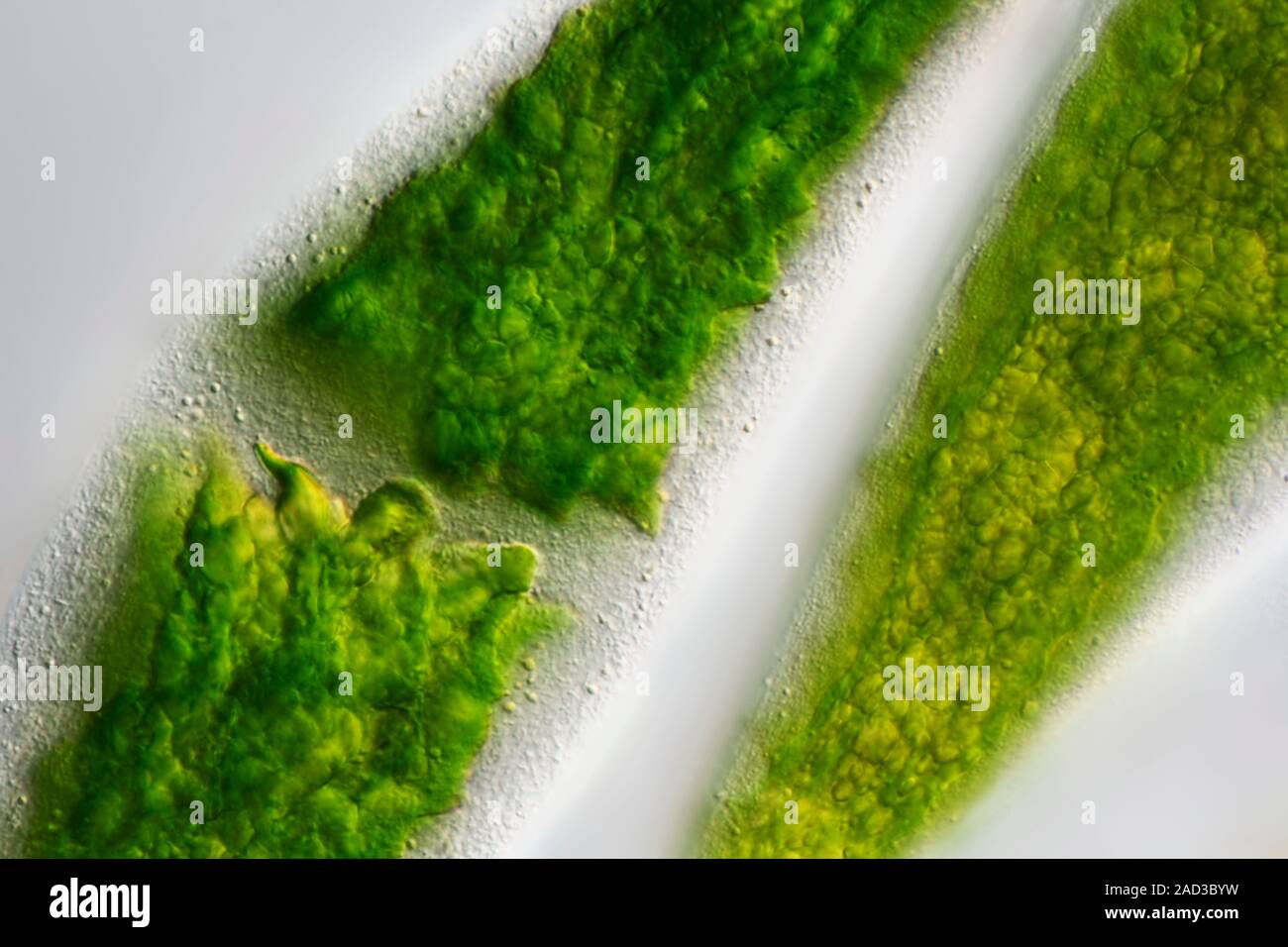 Closterium desmids. Differential interference contrast (DIC) light ...