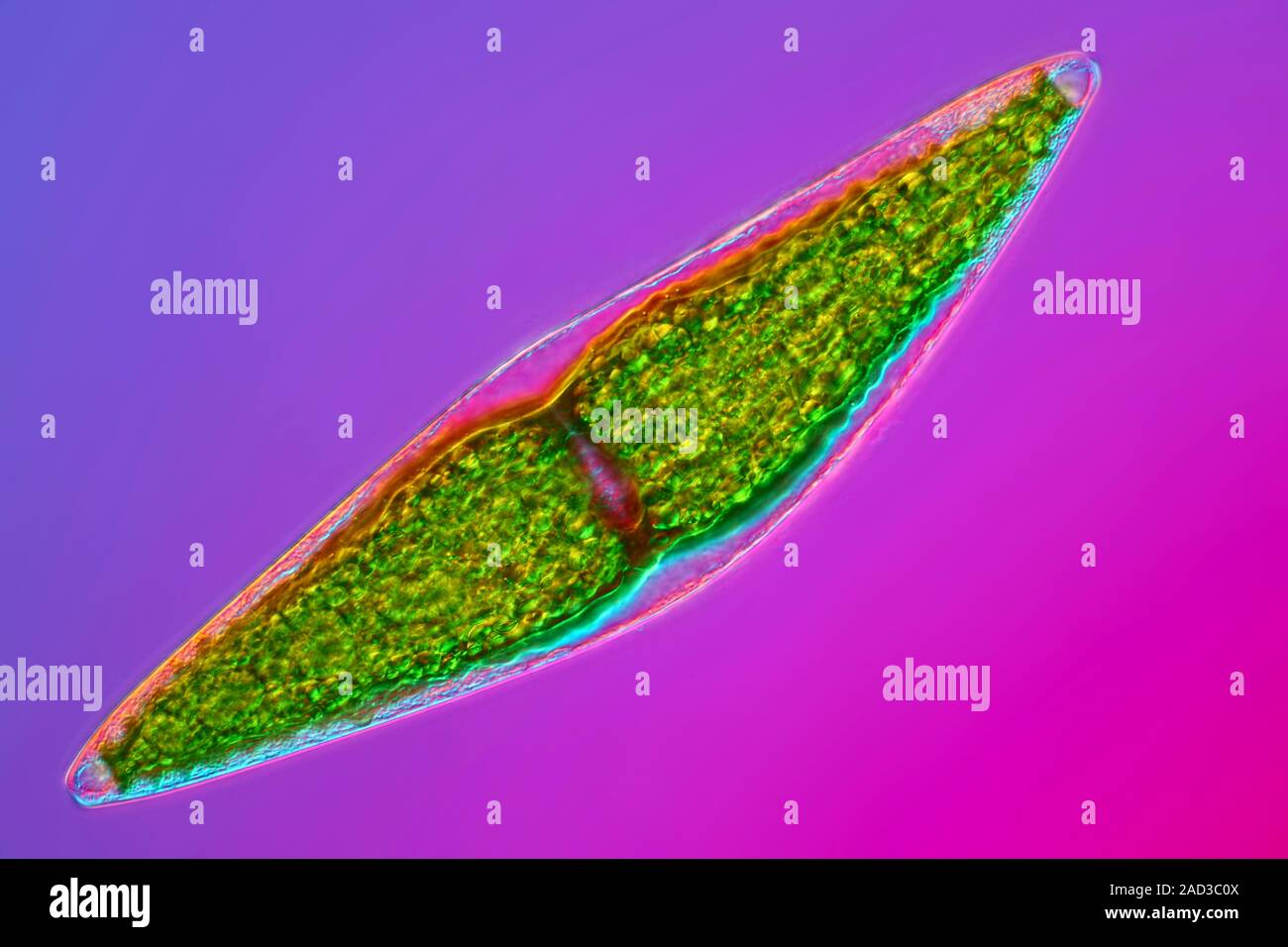 Closterium desmid. Differential interference contrast (DIC) light ...