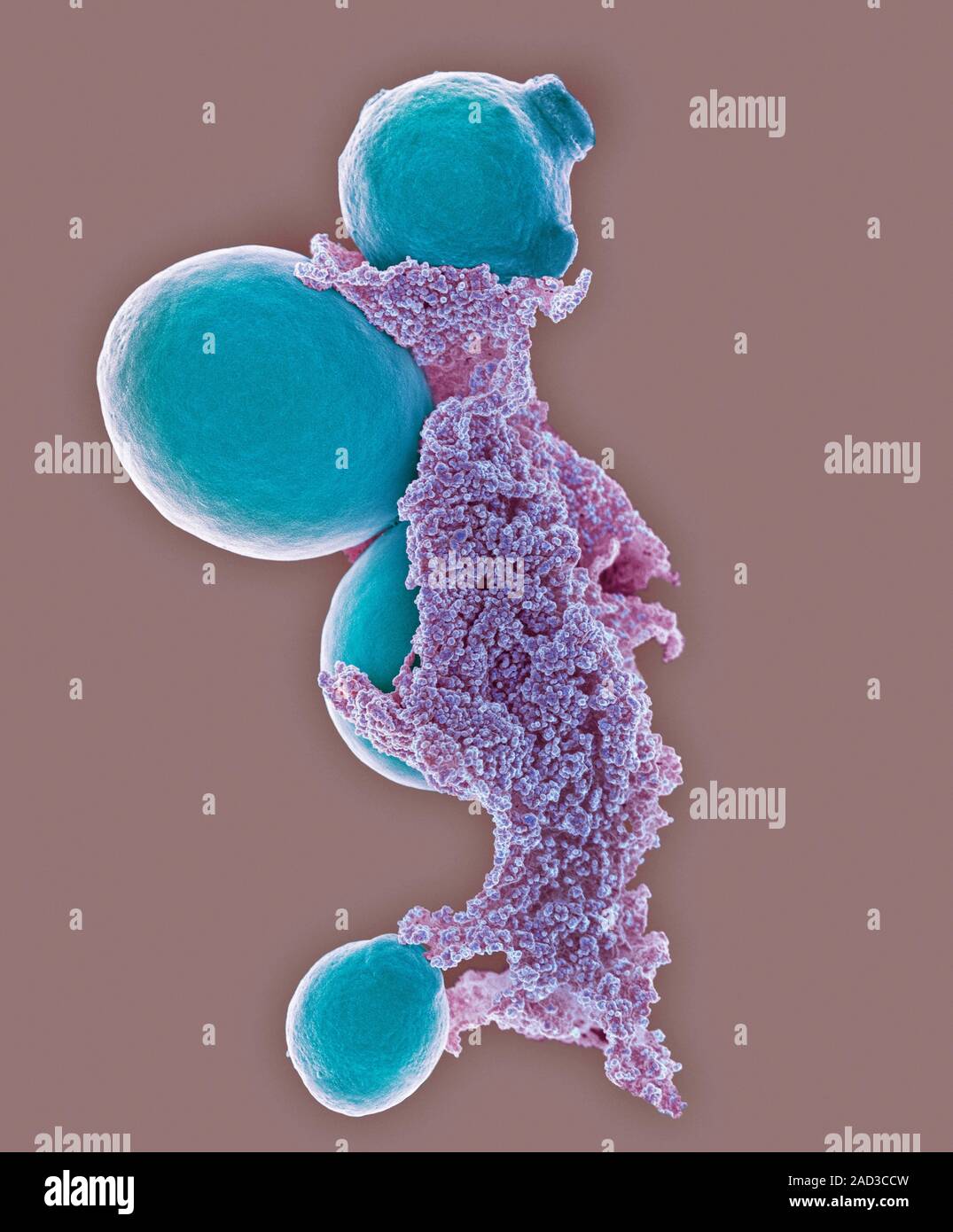 Coloured scanning electron micrograph (SEM) of Candida albicans yeast ...