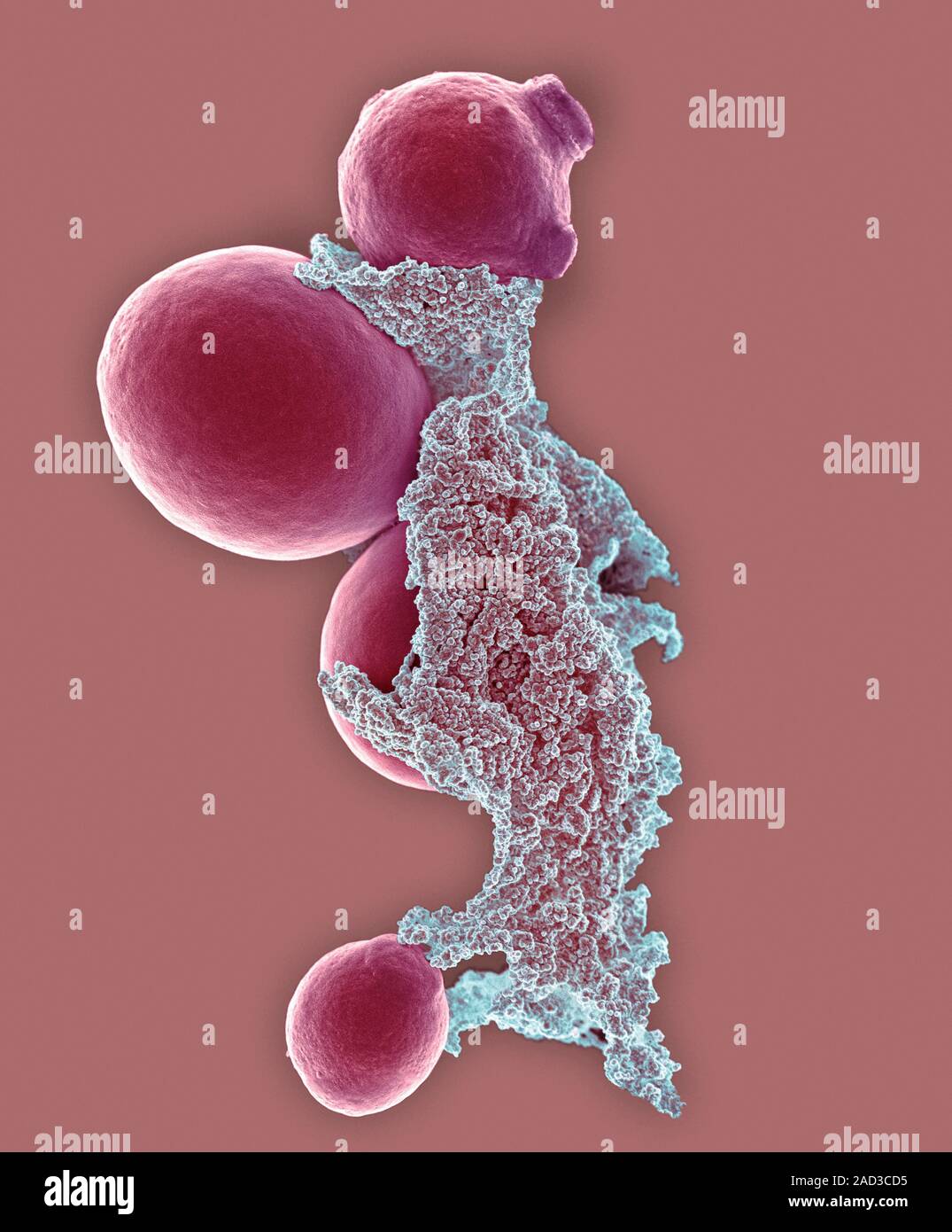 Coloured scanning electron micrograph (SEM) of Candida albicans yeast ...