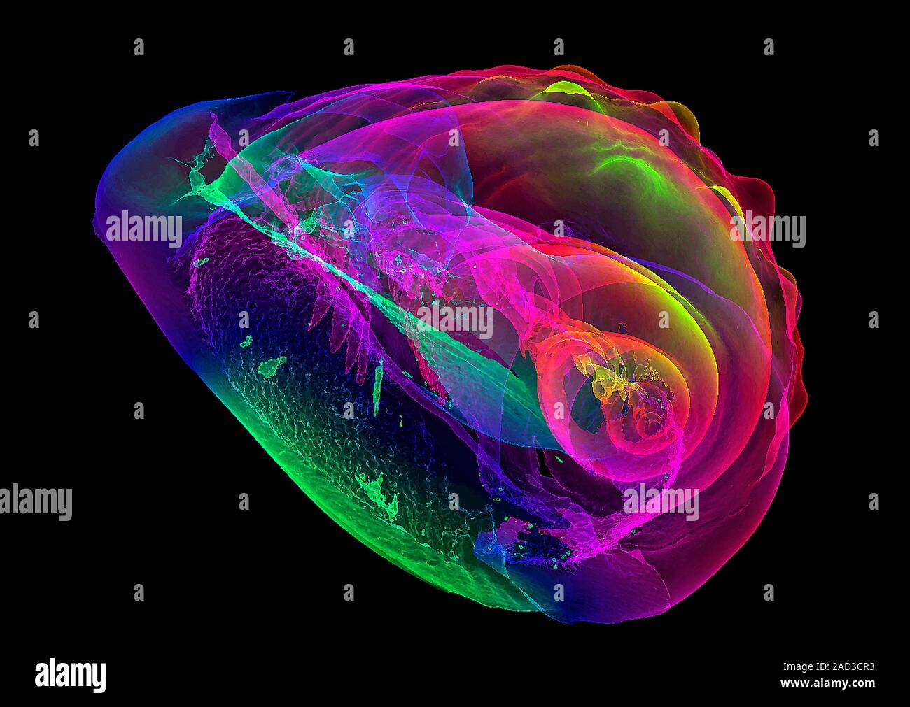 Flame helmet seashell (Cassis flammea). Coloured 3D computed tomography ...