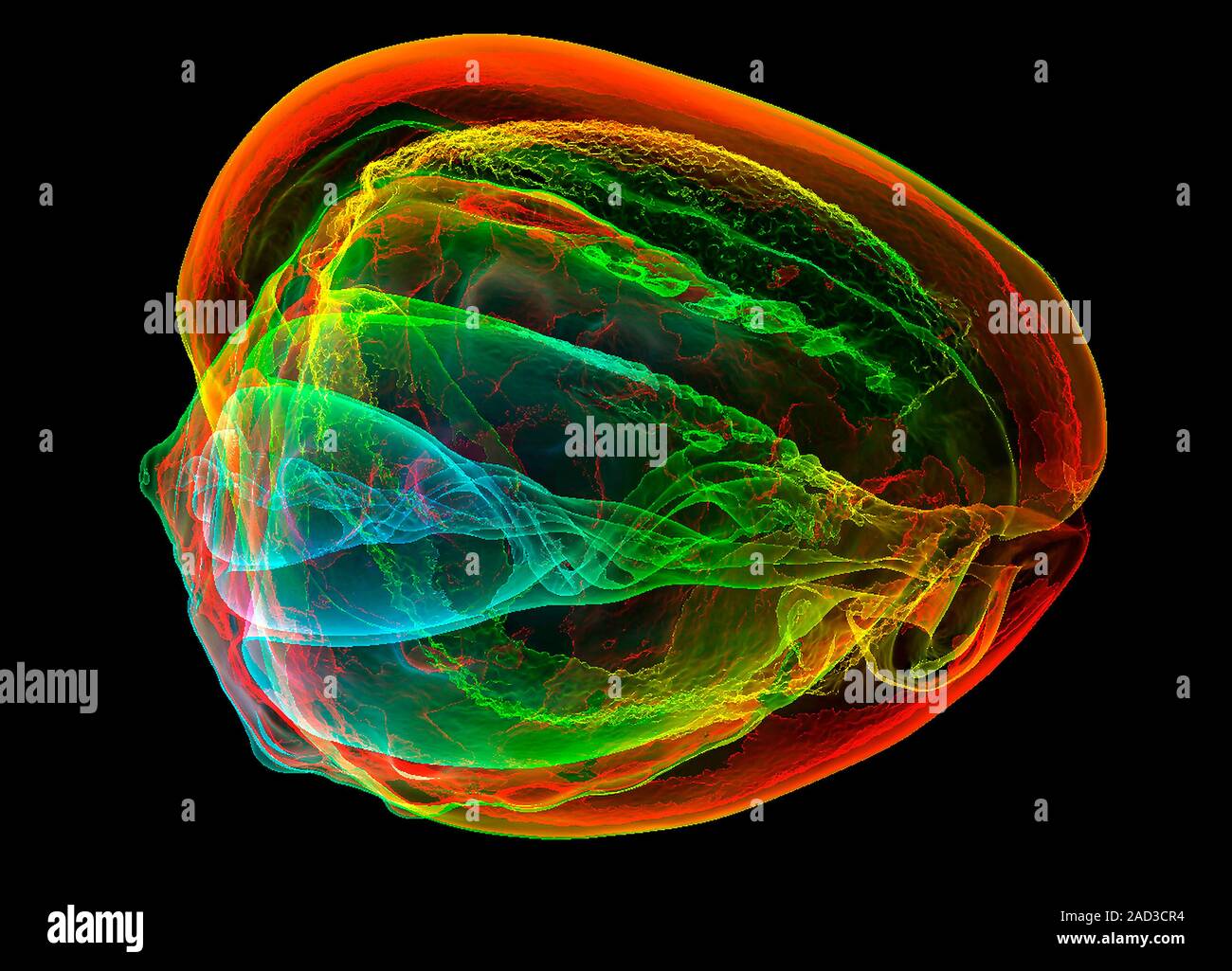 Flame helmet seashell (Cassis flammea). Coloured 3D computed tomography ...