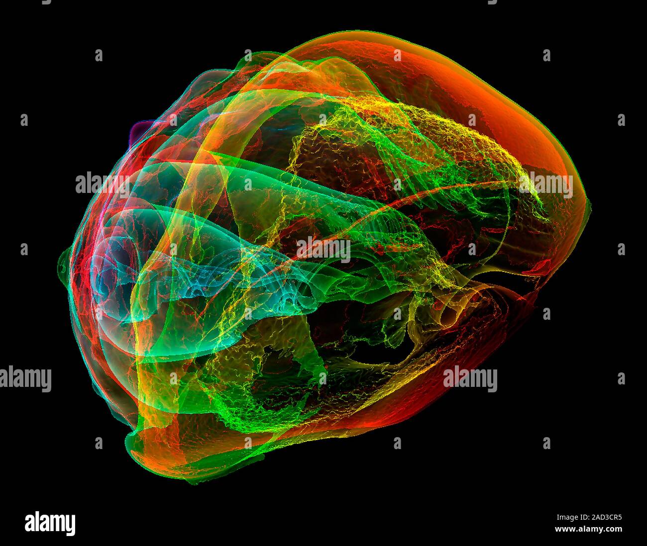 Flame helmet seashell (Cassis flammea). Coloured 3D computed tomography ...