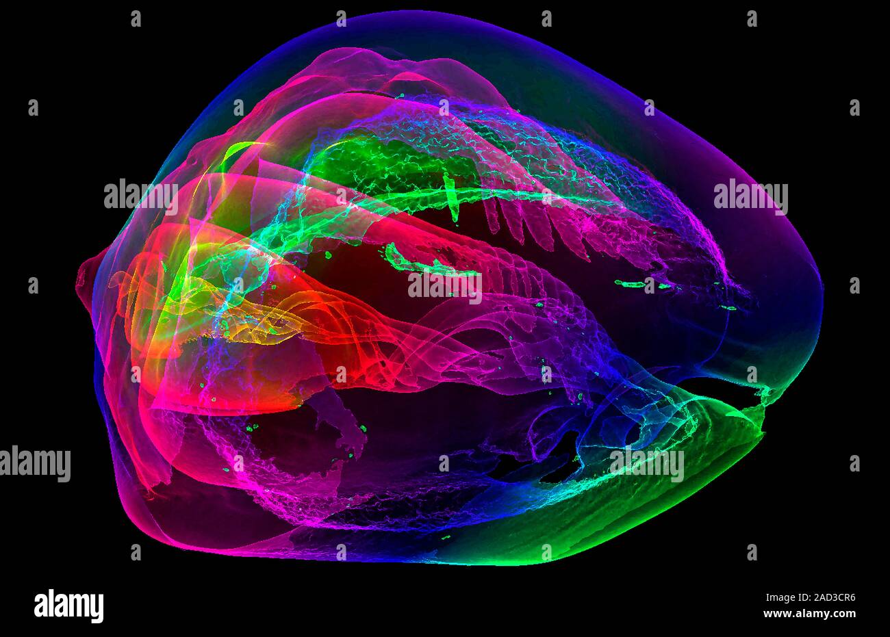 Flame helmet seashell (Cassis flammea). Coloured 3D computed tomography ...