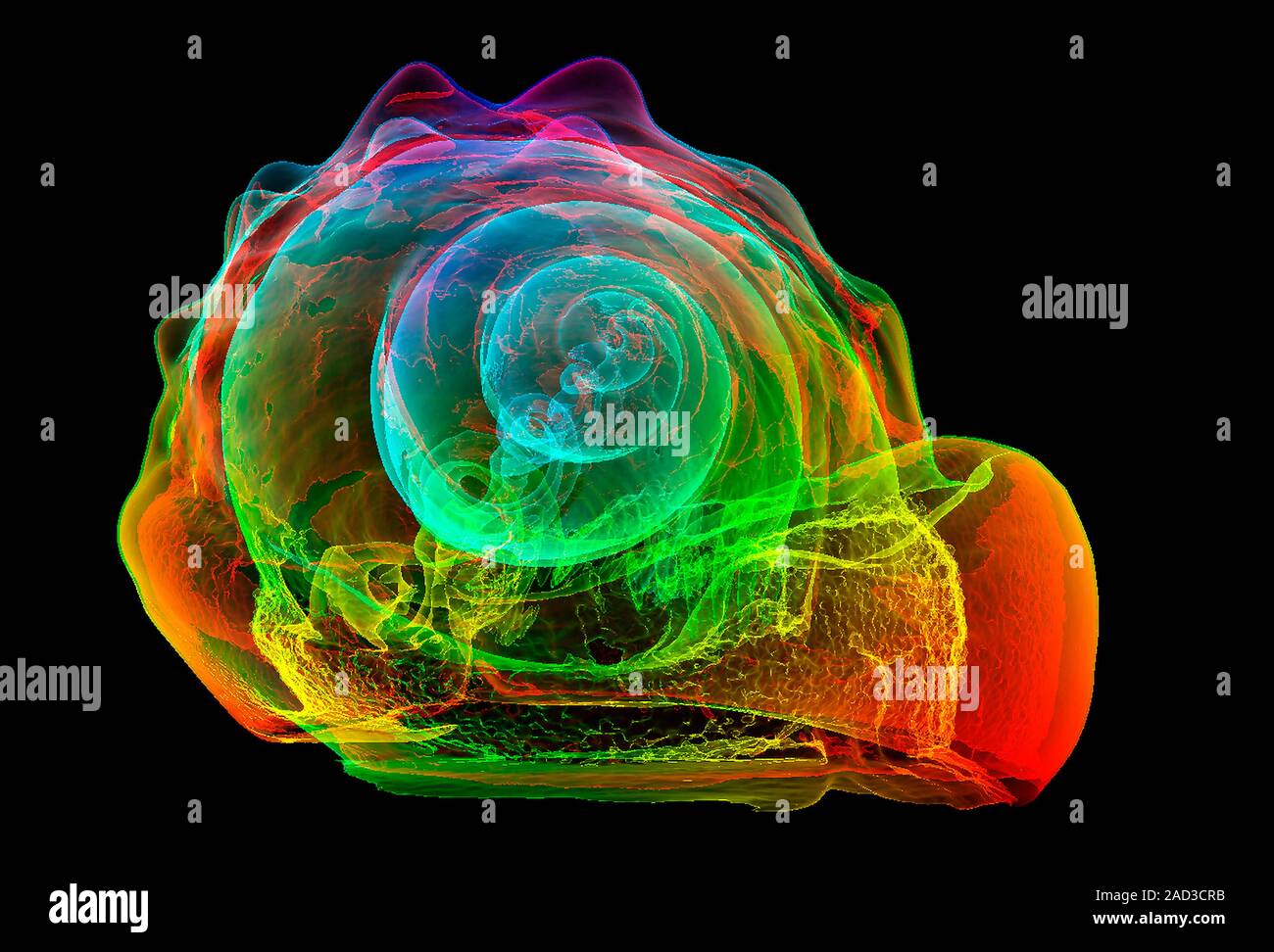 Flame helmet seashell (Cassis flammea). Coloured 3D computed tomography ...