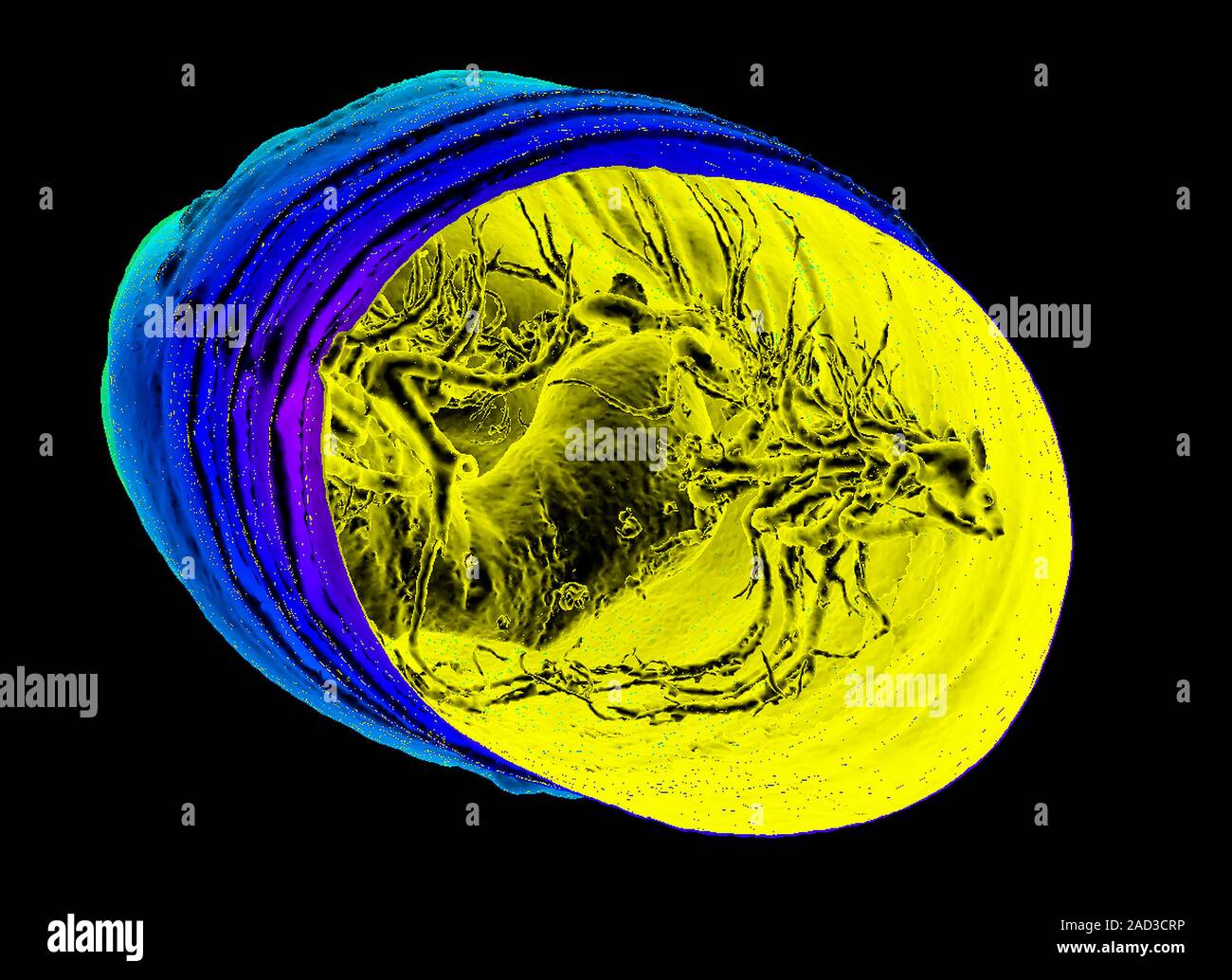 Tussock moth (Arctornis sp.) pupa. Coloured 3D micro-computed ...