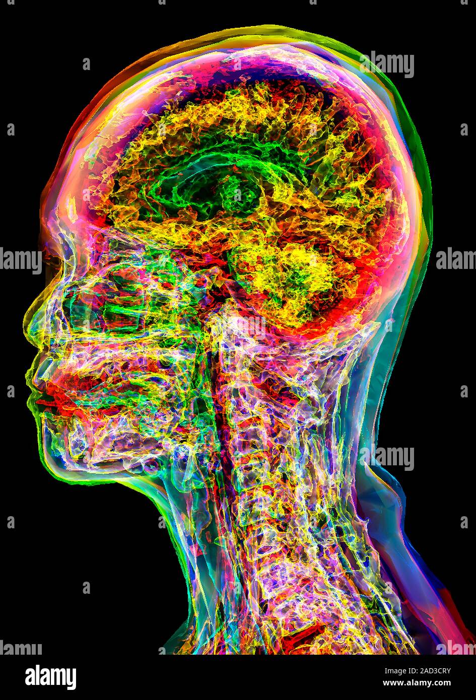 Normal adult head and neck. Coloured 3D magnetic resonance imaging (MRI) scan of a sagittal ...