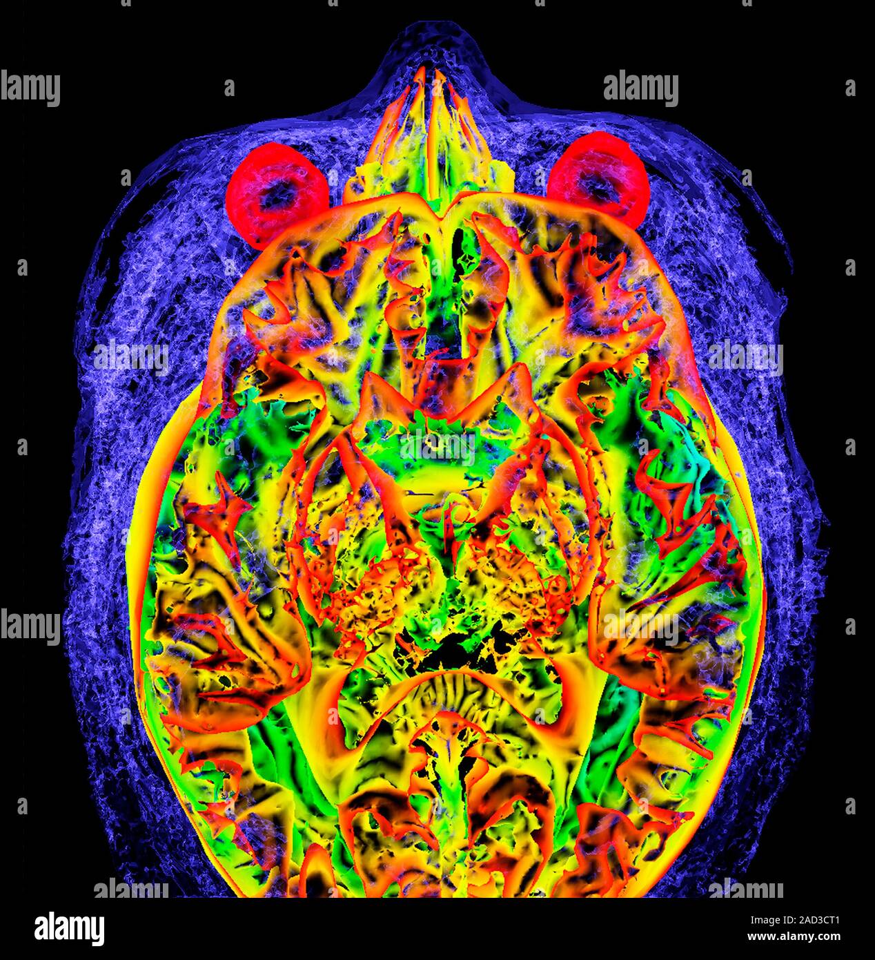 Normal adult brain. Coloured 3D magnetic resonance imaging (MRI) scan ...