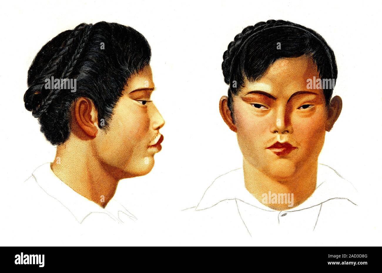 Siamese man. 1868 illustration of the head of a Siamese (Thai) man ...