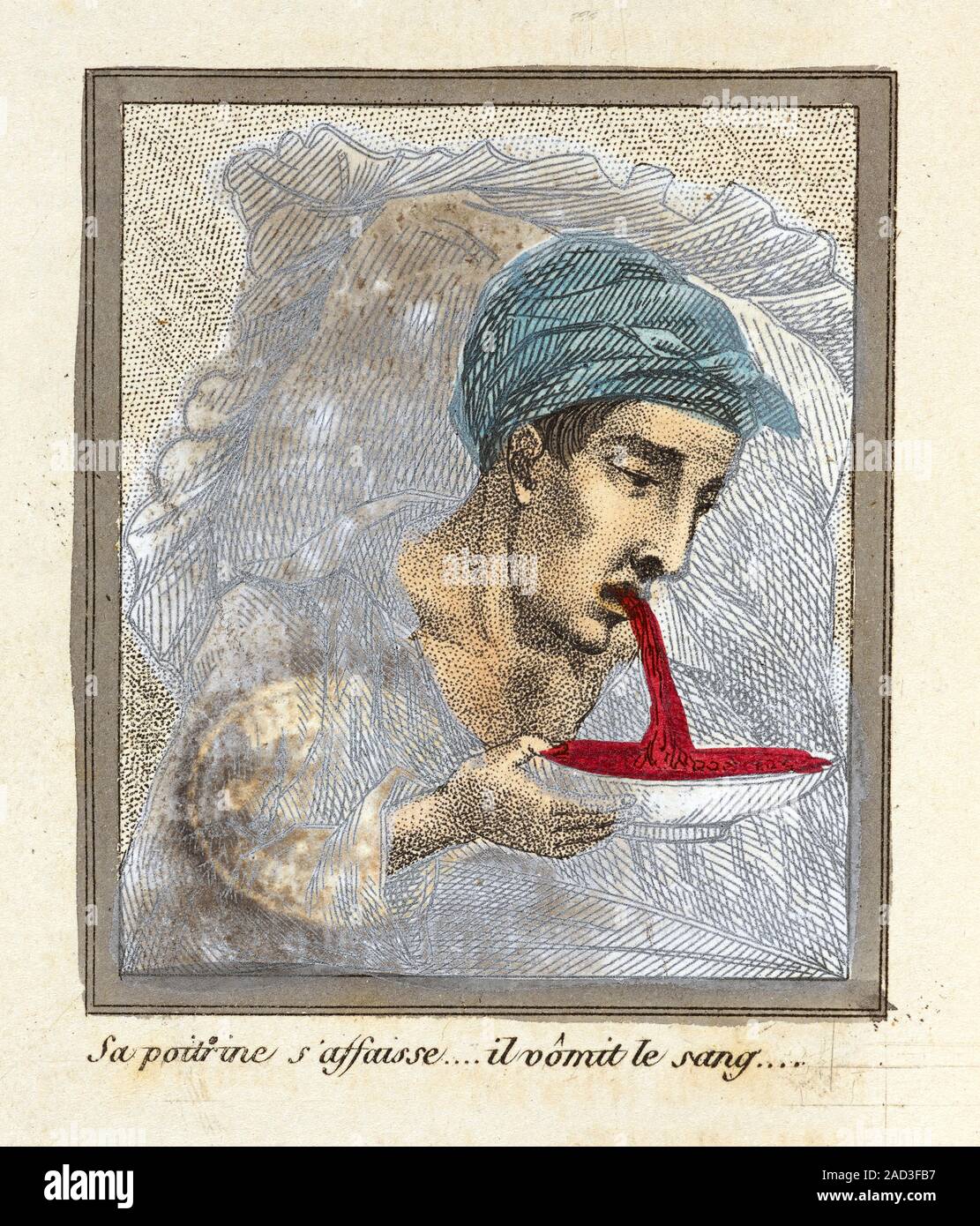 Masturbation health booklet. 19th-century illustration of a man said to ...