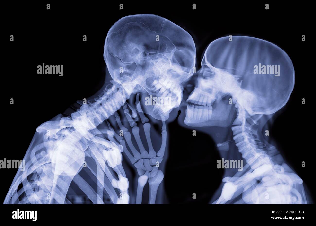 Lovers kissing, X-ray. The X-ray has revealed the bones of their heads ...