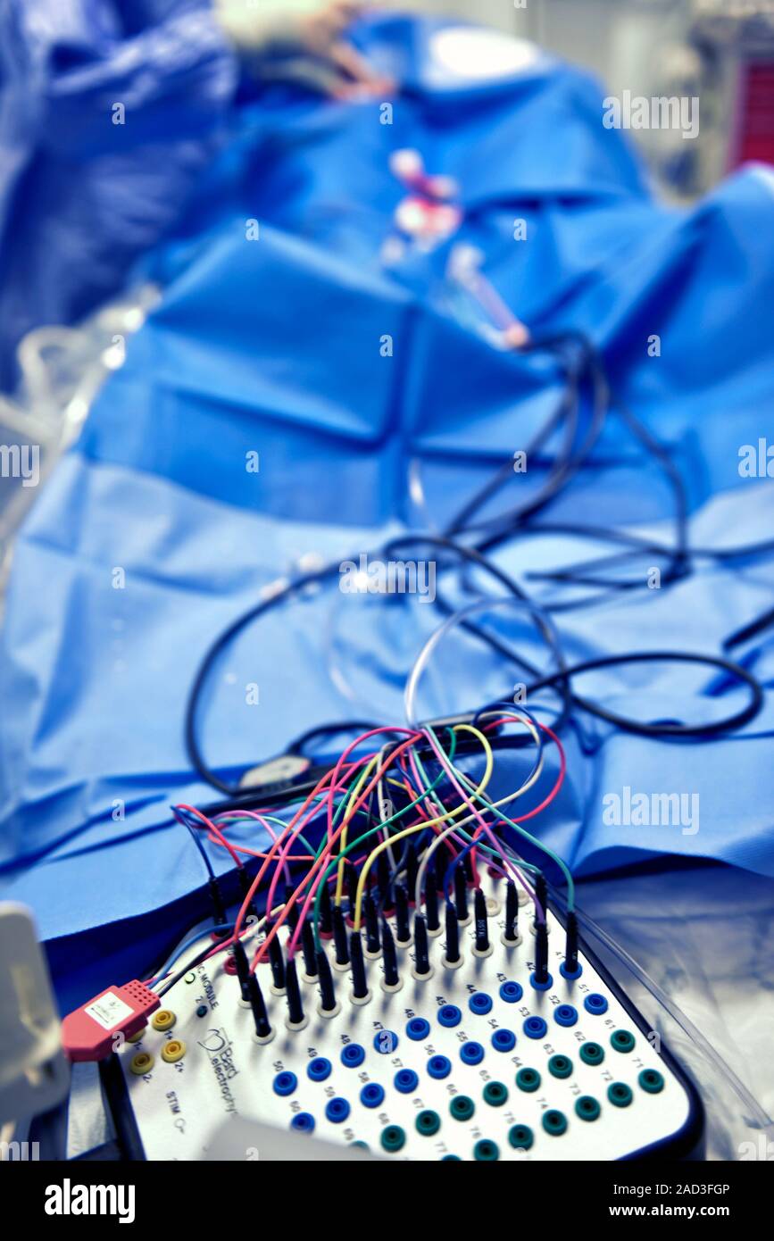 Heart surgery electrophysiology wires. Control box and wires being used ...