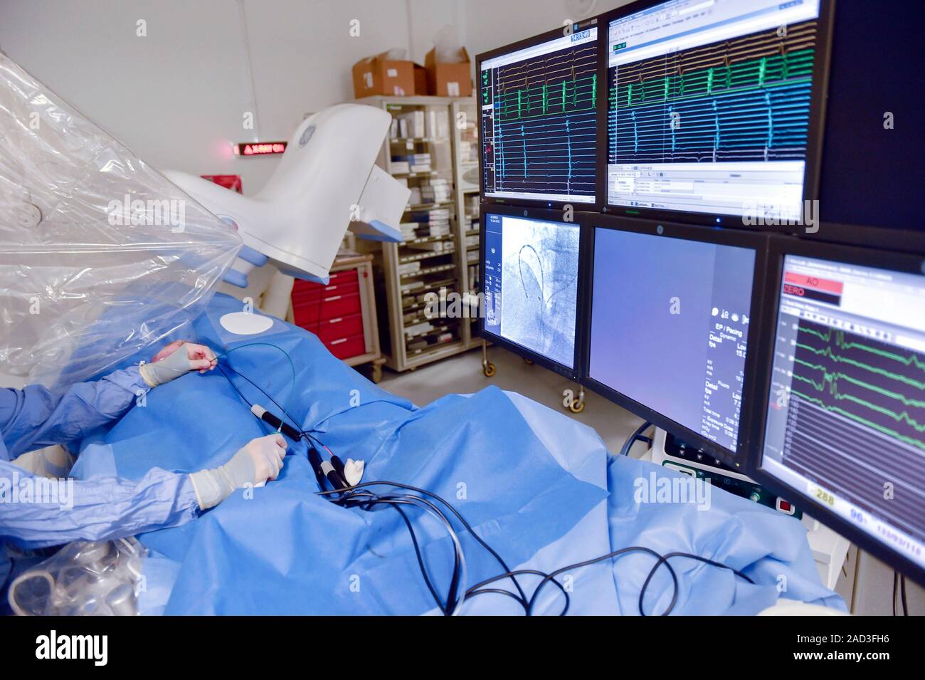 Cardiac ablation surgery screens. Monitors and equipment being used ...