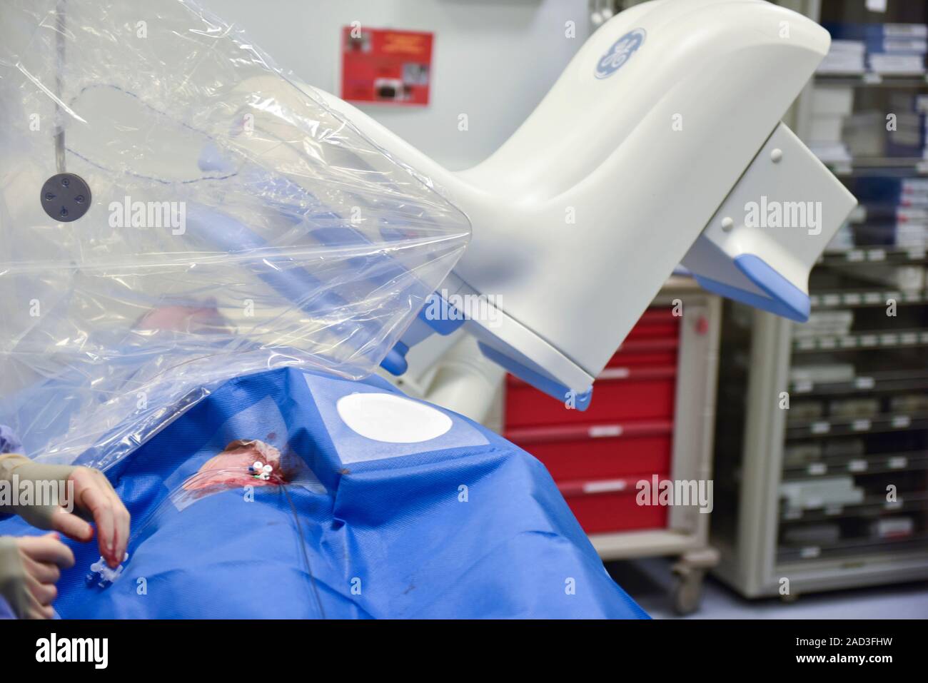 Cardiac ablation surgery. Surgeons using an X-ray machine (upper right ...