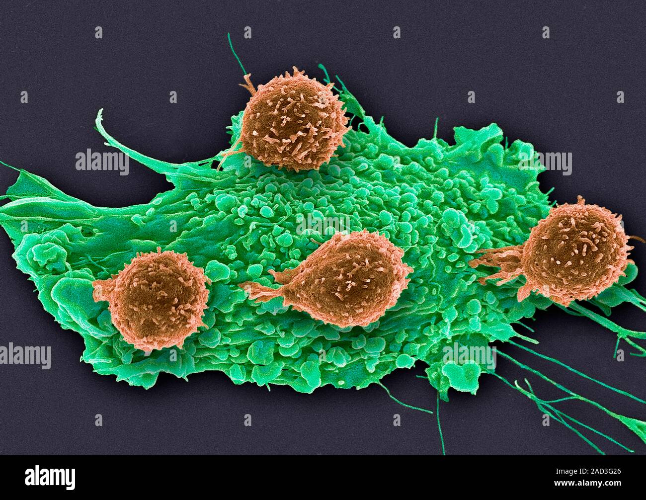 T lymphocytes and cancer cell. Coloured scanning electron micrograph ...