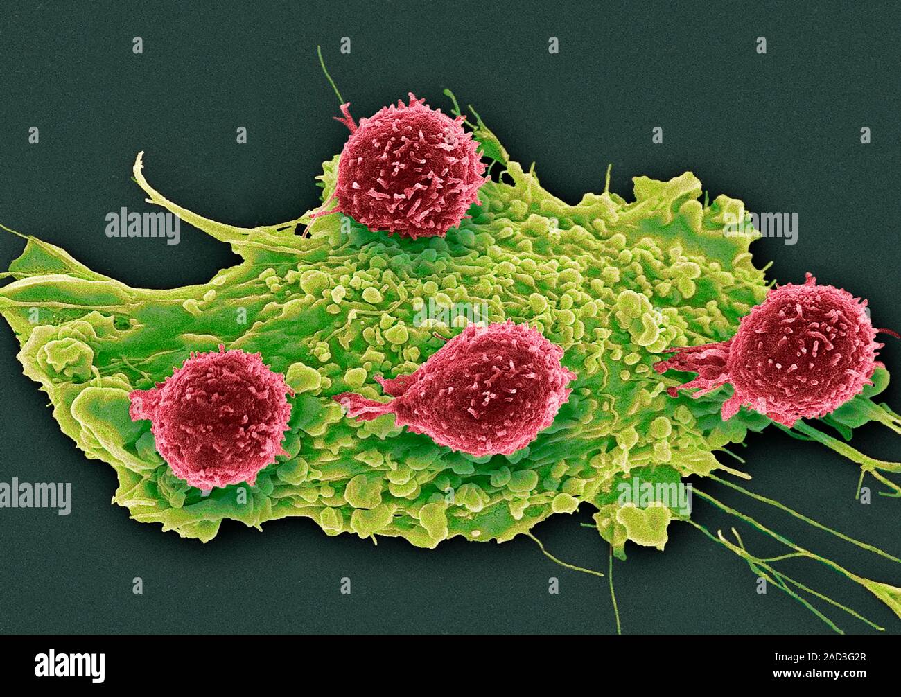 T lymphocytes and cancer cell. Coloured scanning electron micrograph ...