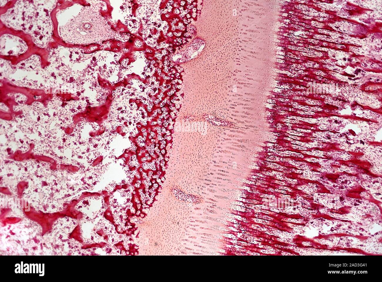 Longitudinal section of developing lamb bone showing cartilage ...