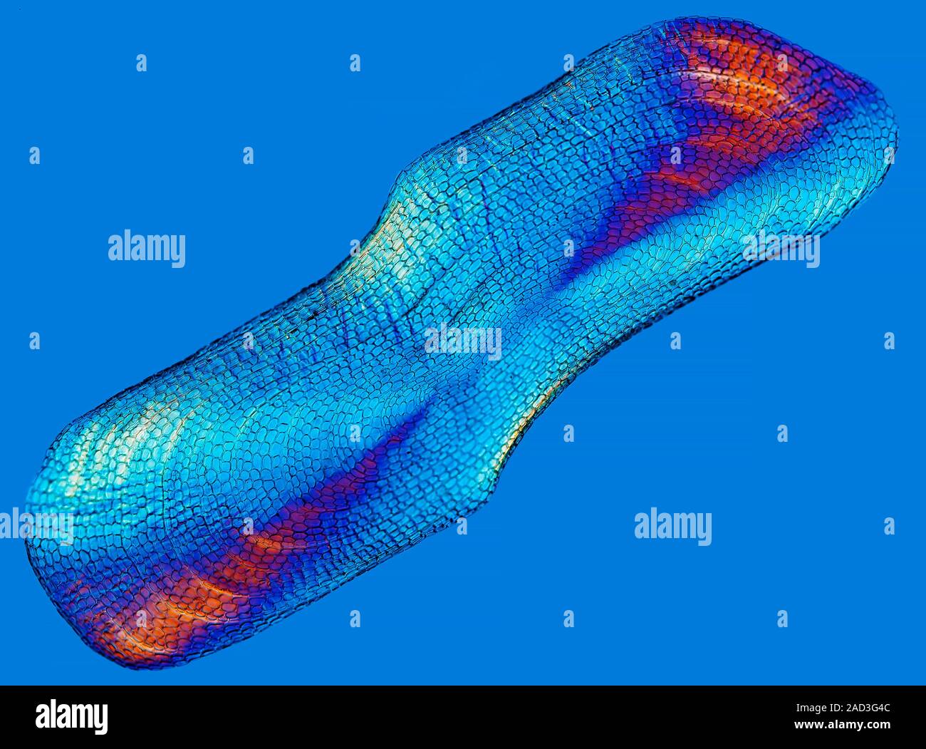 Polarised light microscopy of an eel (Anguilla sp.) scale. Unlike the ...
