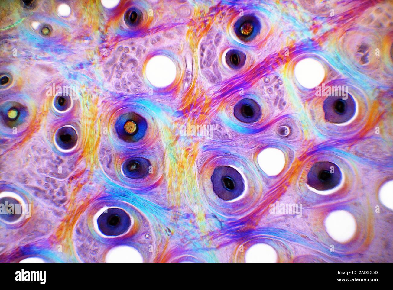 Polarised light microscopy of tangential section of human scalp showing ...