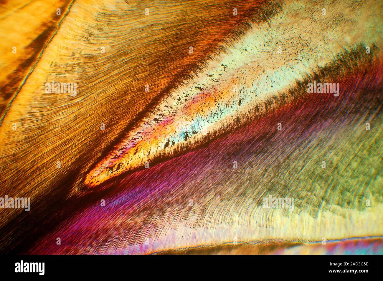 Polarised light microscopy of section of human tooth showing central ...