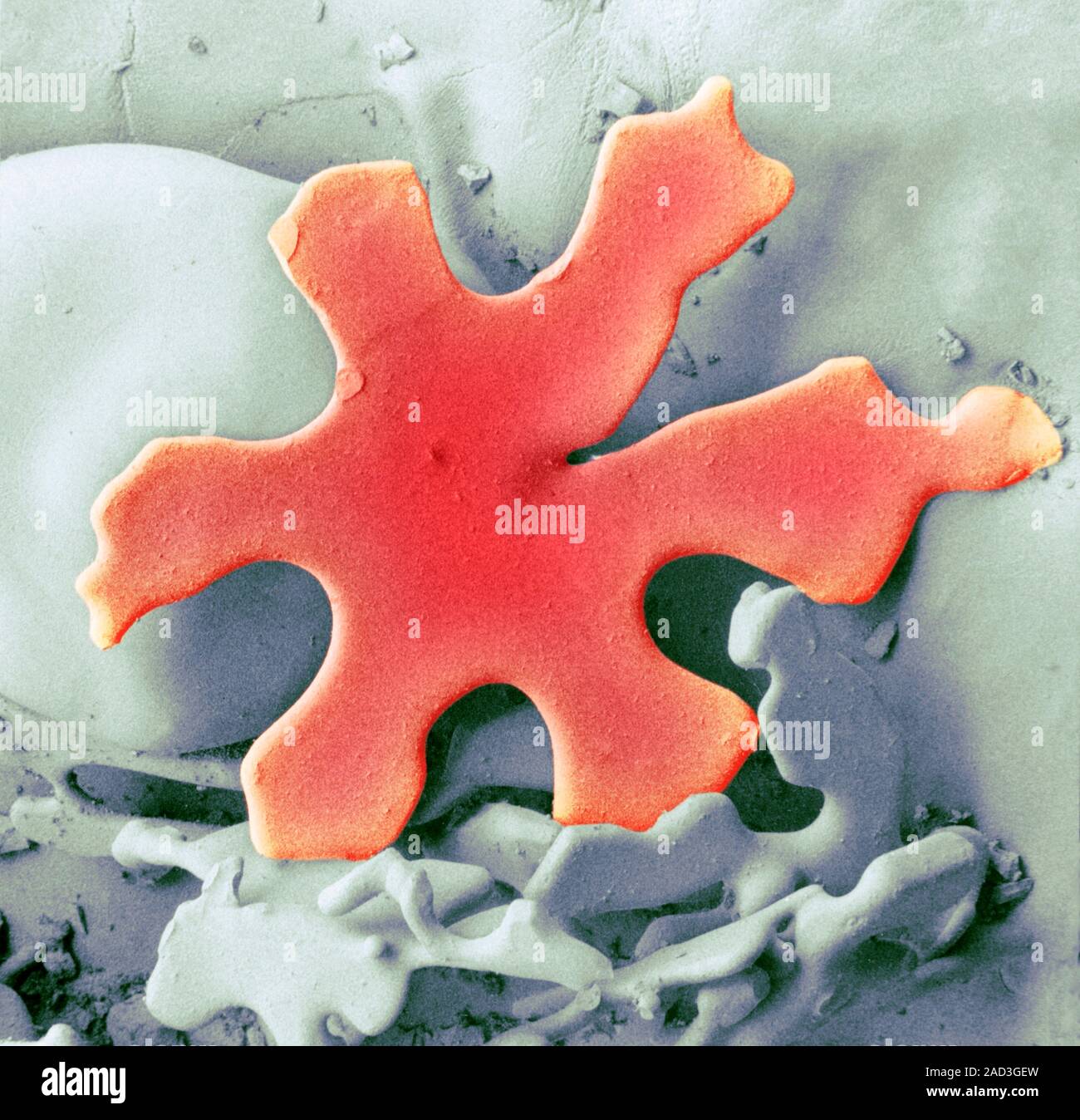 Snowflake. Coloured low-temperature scanning electron micrograph (LT ...