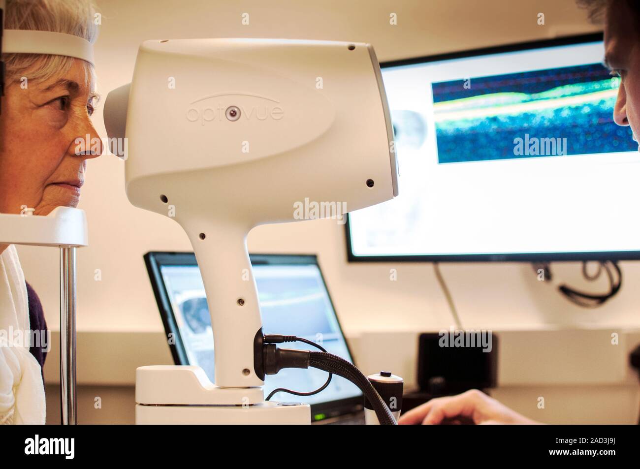 Retinal scan testing for glaucoma. Woman with her head resting in a ...