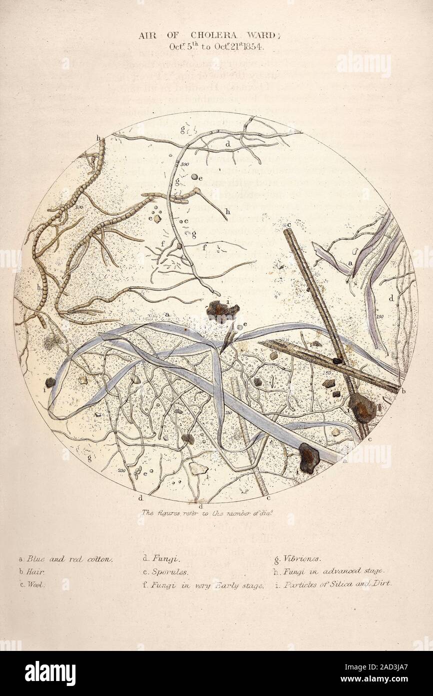 Cholera epidemic research. Illustration of a microscope view of ...