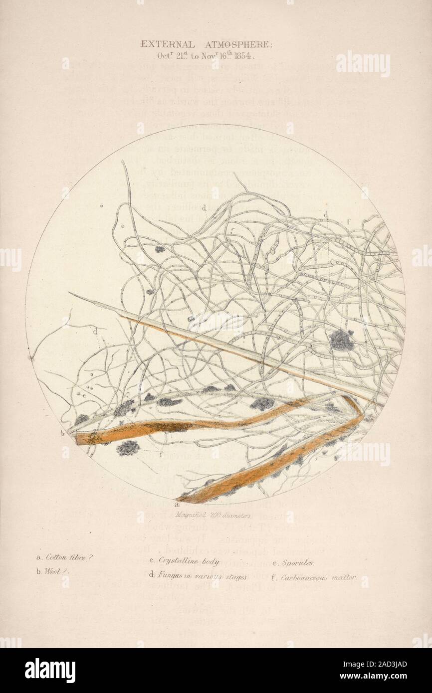 Cholera epidemic research. Illustration of a microscope view of ...
