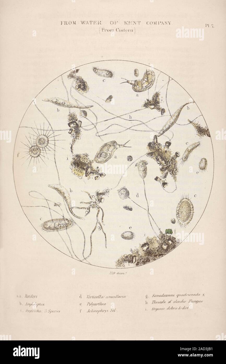 Cholera epidemic research. Illustration of a microscope view of objects ...
