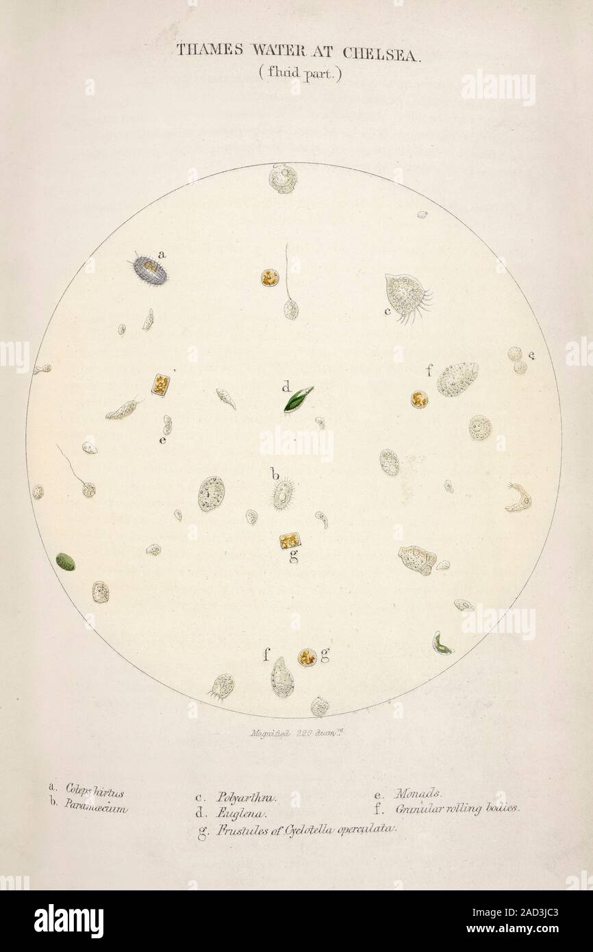 Cholera epidemic research. Illustration of a microscope view of objects ...