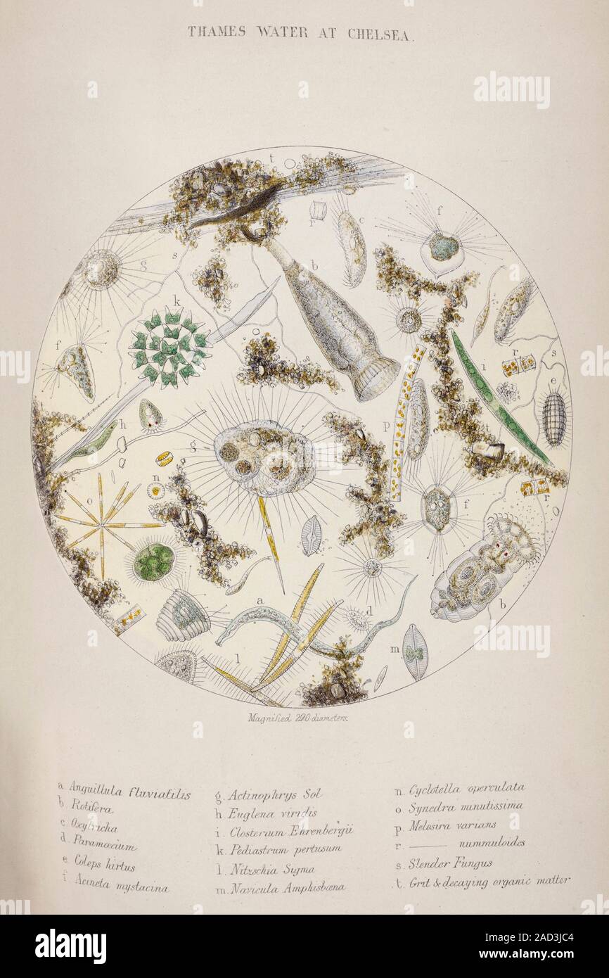 Cholera epidemic research. Illustration of a microscope view of objects ...