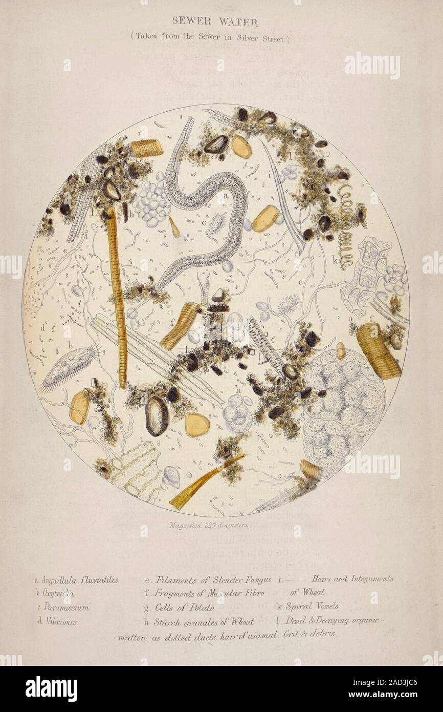 Cholera epidemic research. Illustration of a microscope view of ...
