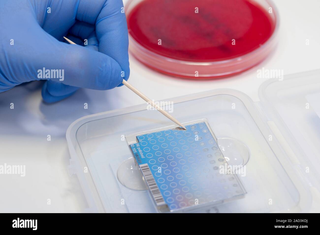 Hospital pathology lab. Close-up of a microbiologist preparing a sample ...