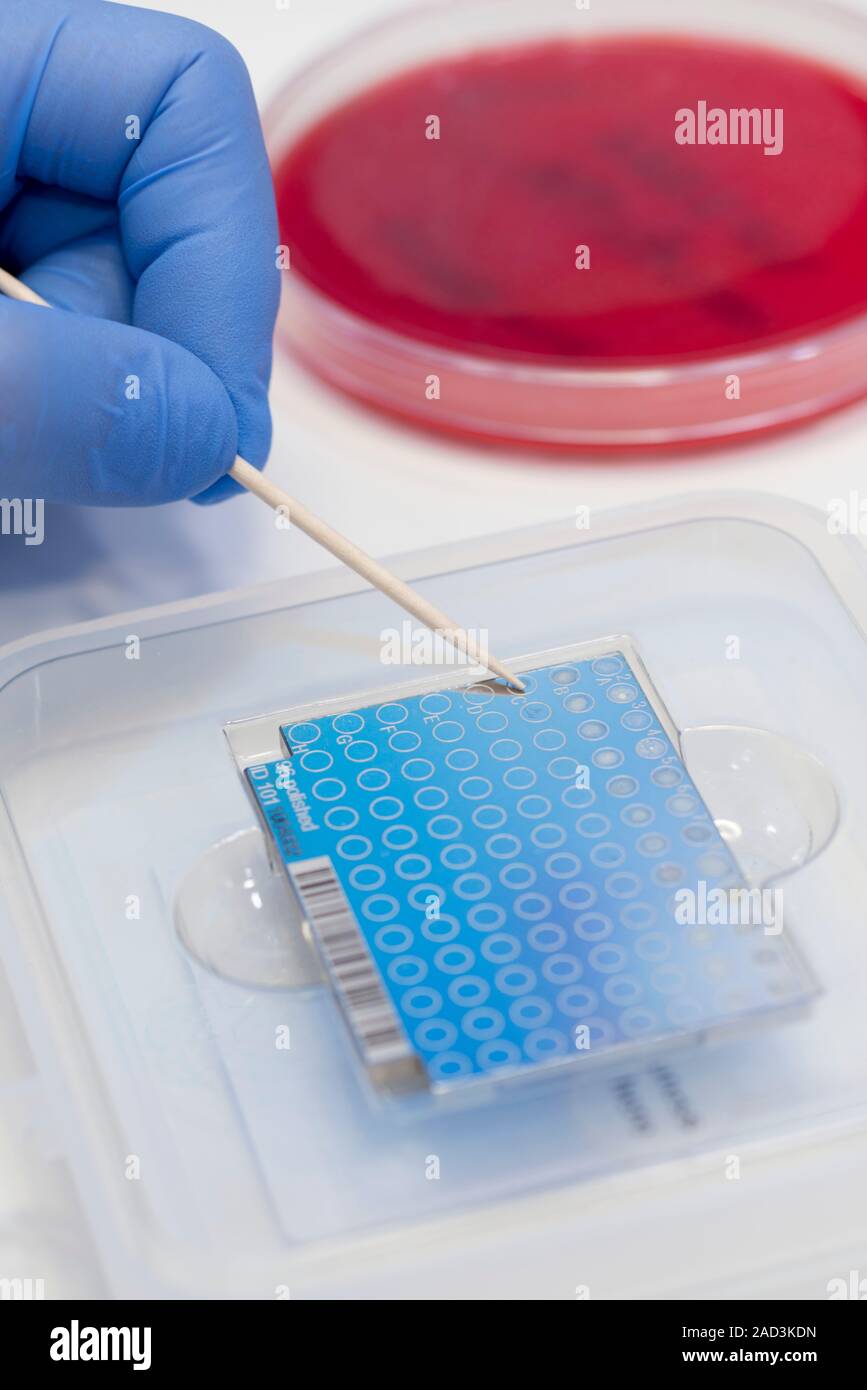 Hospital pathology lab. Close-up of a microbiologist preparing a sample ...