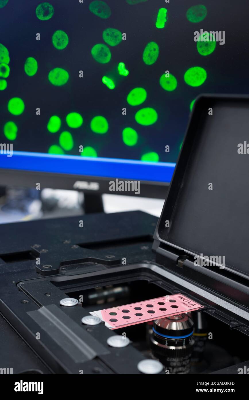 Nova View automated pathology microscope. Nova View automated ...